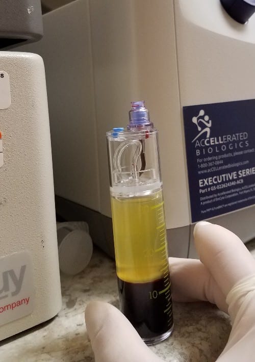 PRP Therapy for Rock Island IL | Davinci Med